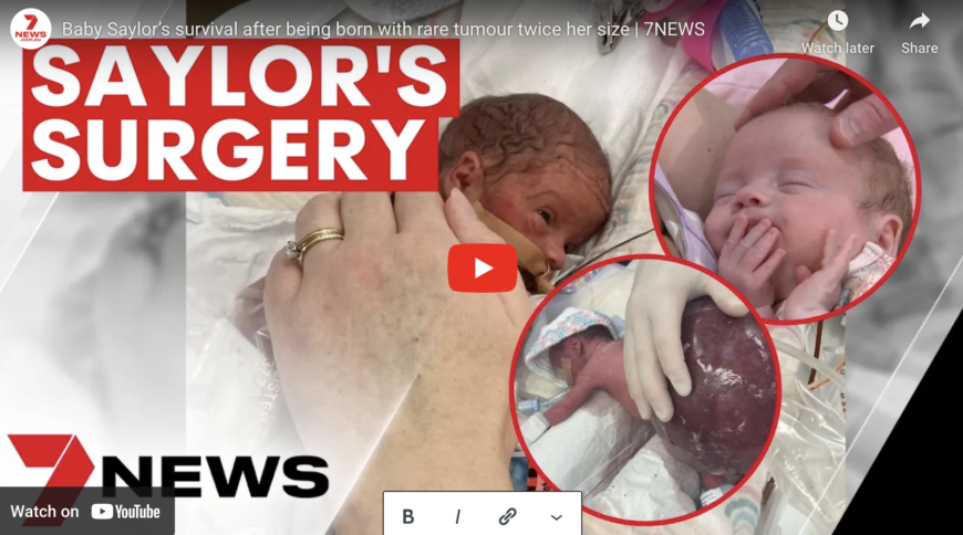 Baby Saylor’s survives after being born with rare tumor twice her size